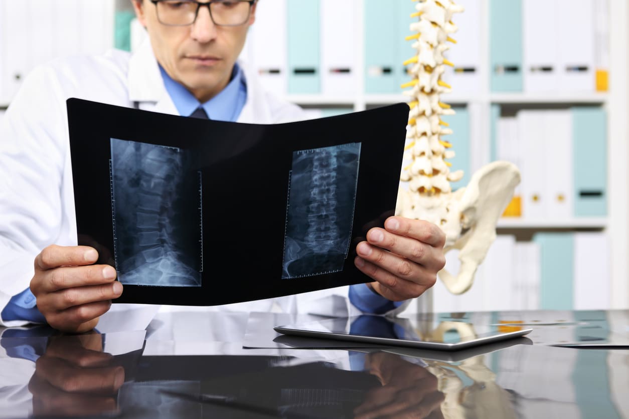What Doctor Do I See for Back Pain?