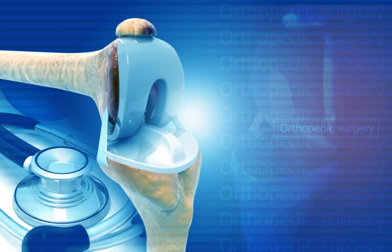 Primary Knee Surgery vs. Revision Knee Surgery